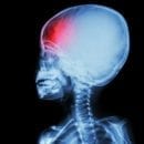 Traumatic Brain Injuries in Children | Ask Dr Sears